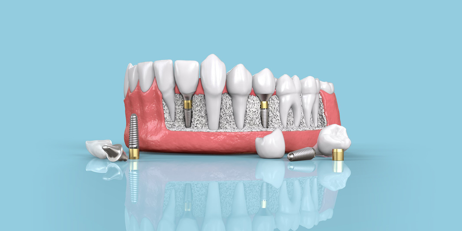 Dentepol – Ağız ve Diş Sağlığı Polikliniği